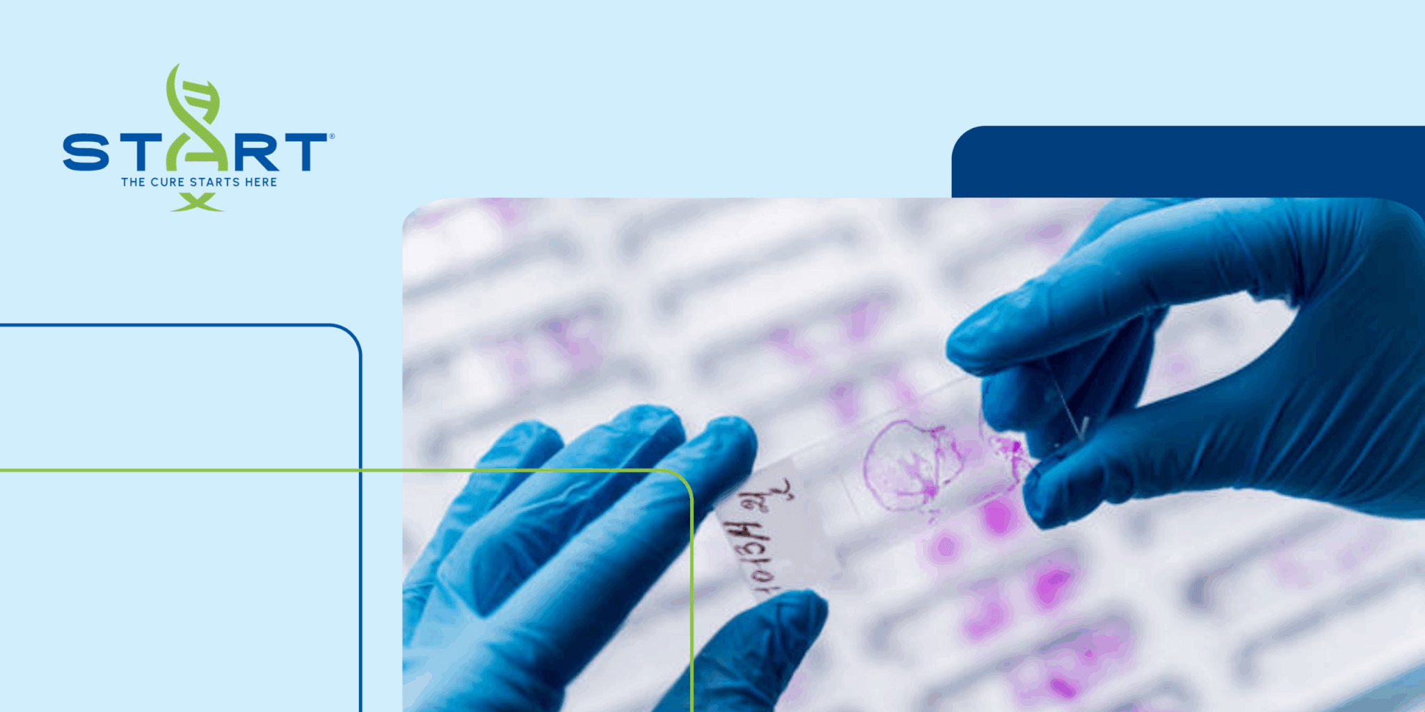 Early Phase - The START Center for Cancer Research